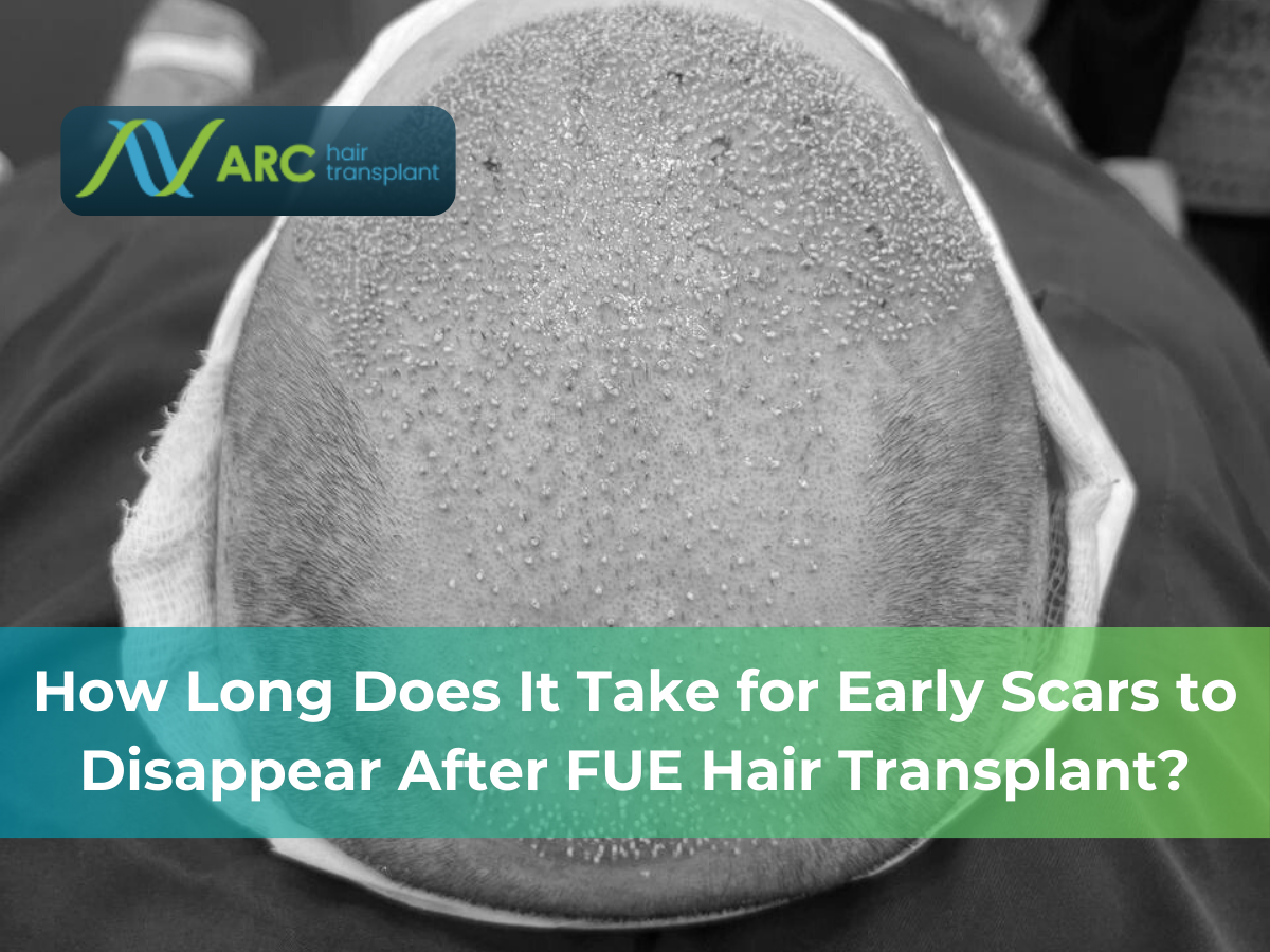 How Long Does It Take for Early FUE Scars Healing? - ARC Hair Transplant